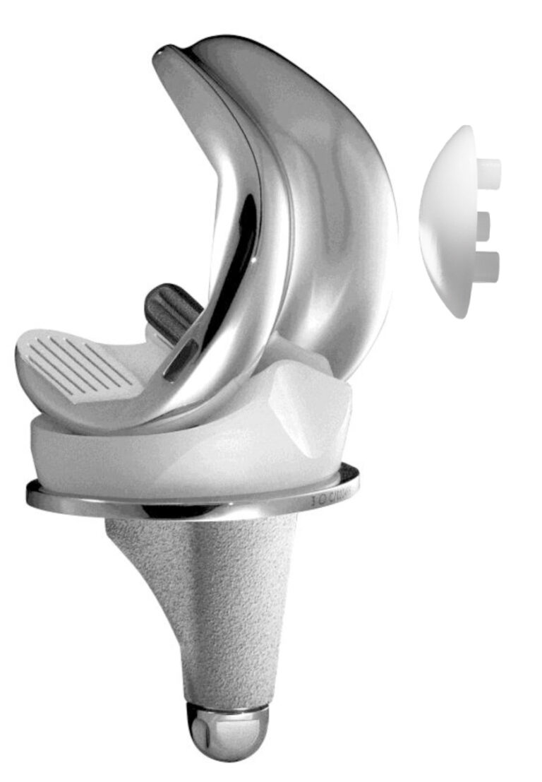 Types of Implants Used in Total Knee Replacement - Dr. Arun Reddy Mallu